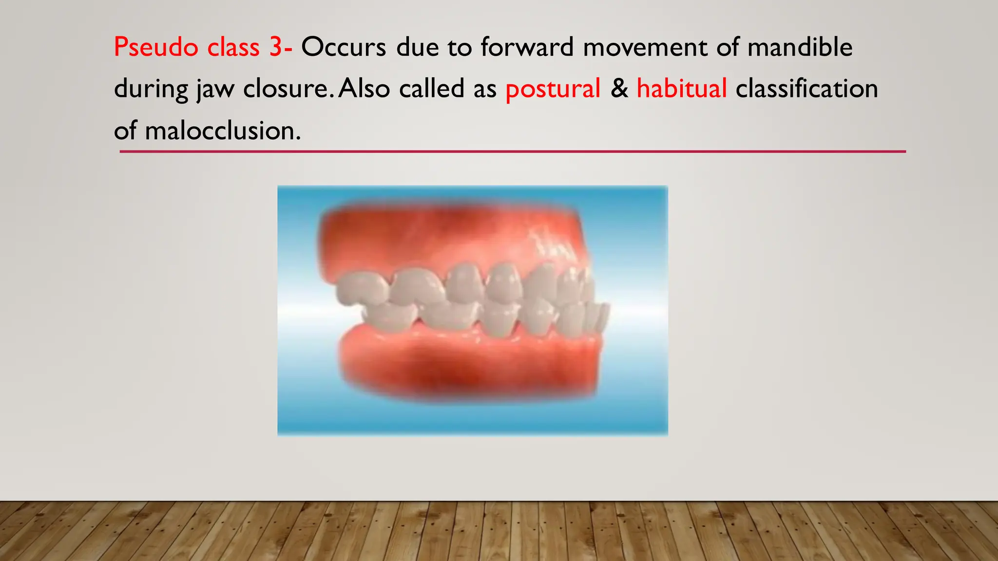 Classification of malocclusion various types of malocclusion | PDF