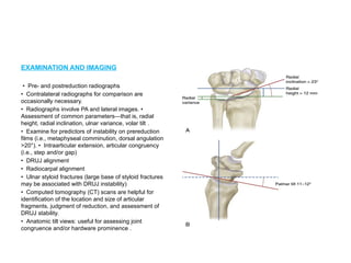 Distal radius fracture fixation operative technique .pptx