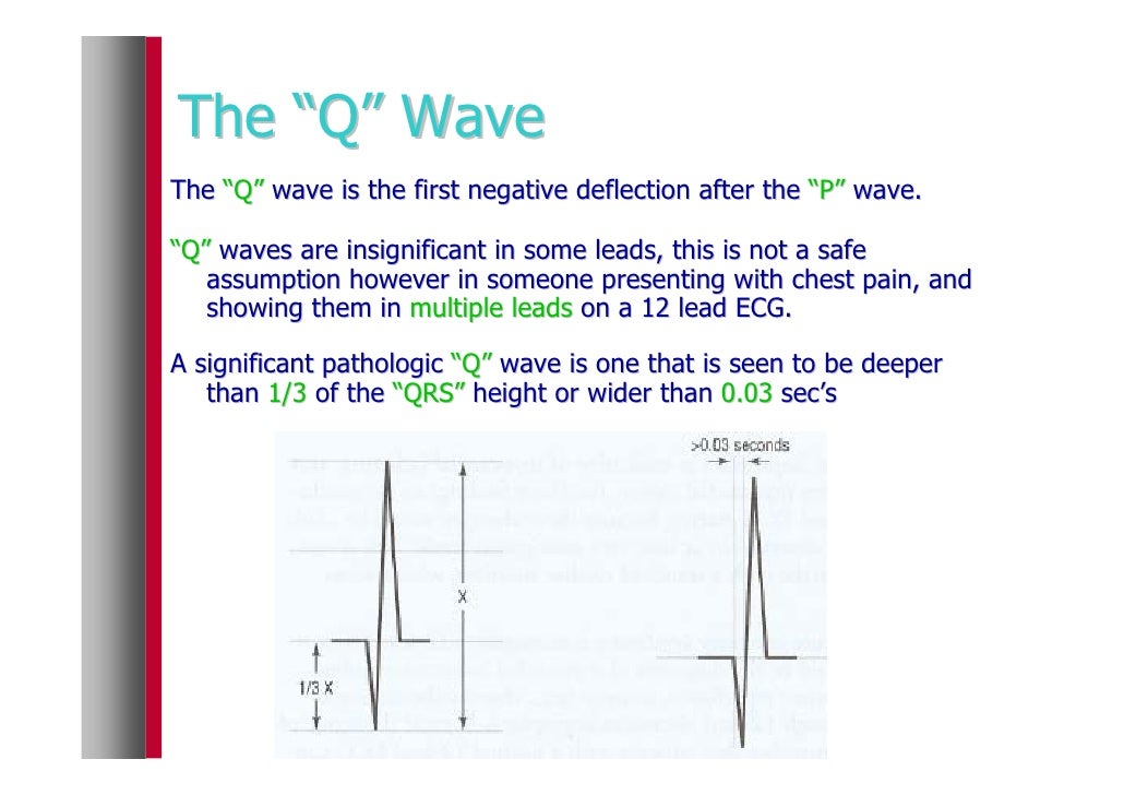 Presentation e acls aremt