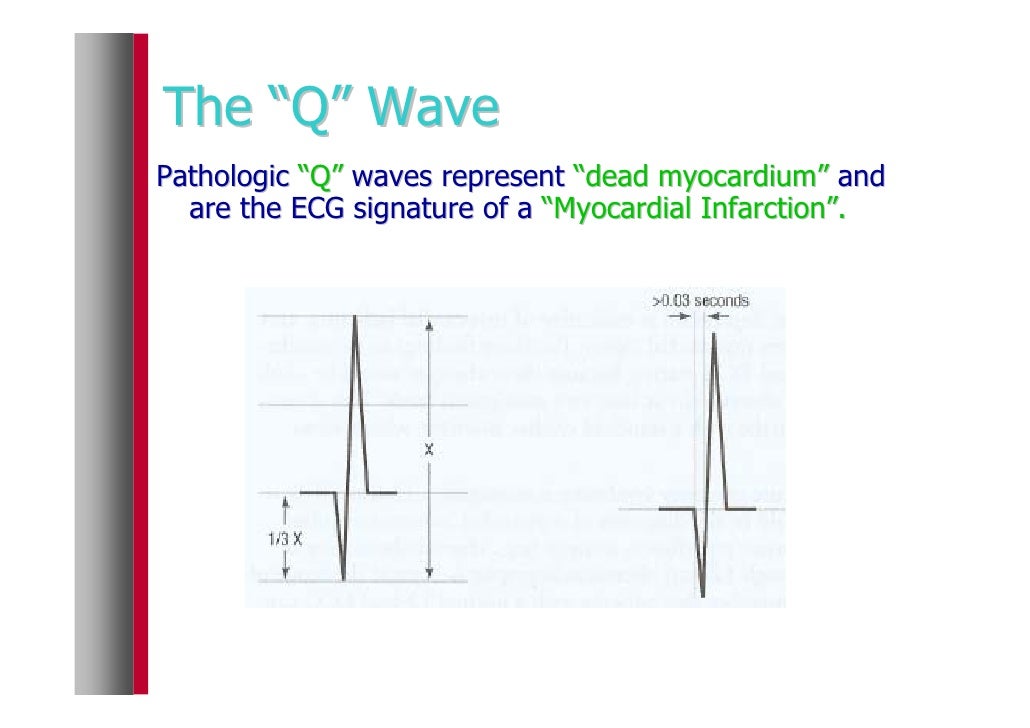 Presentation e acls aremt