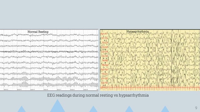 Presentation on History of Electrical Measuring Instruments EEG(2).pptx