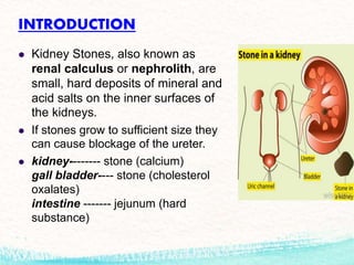 presentation-kidney-stonefinal-150522095756-lva1-app6891.pdf