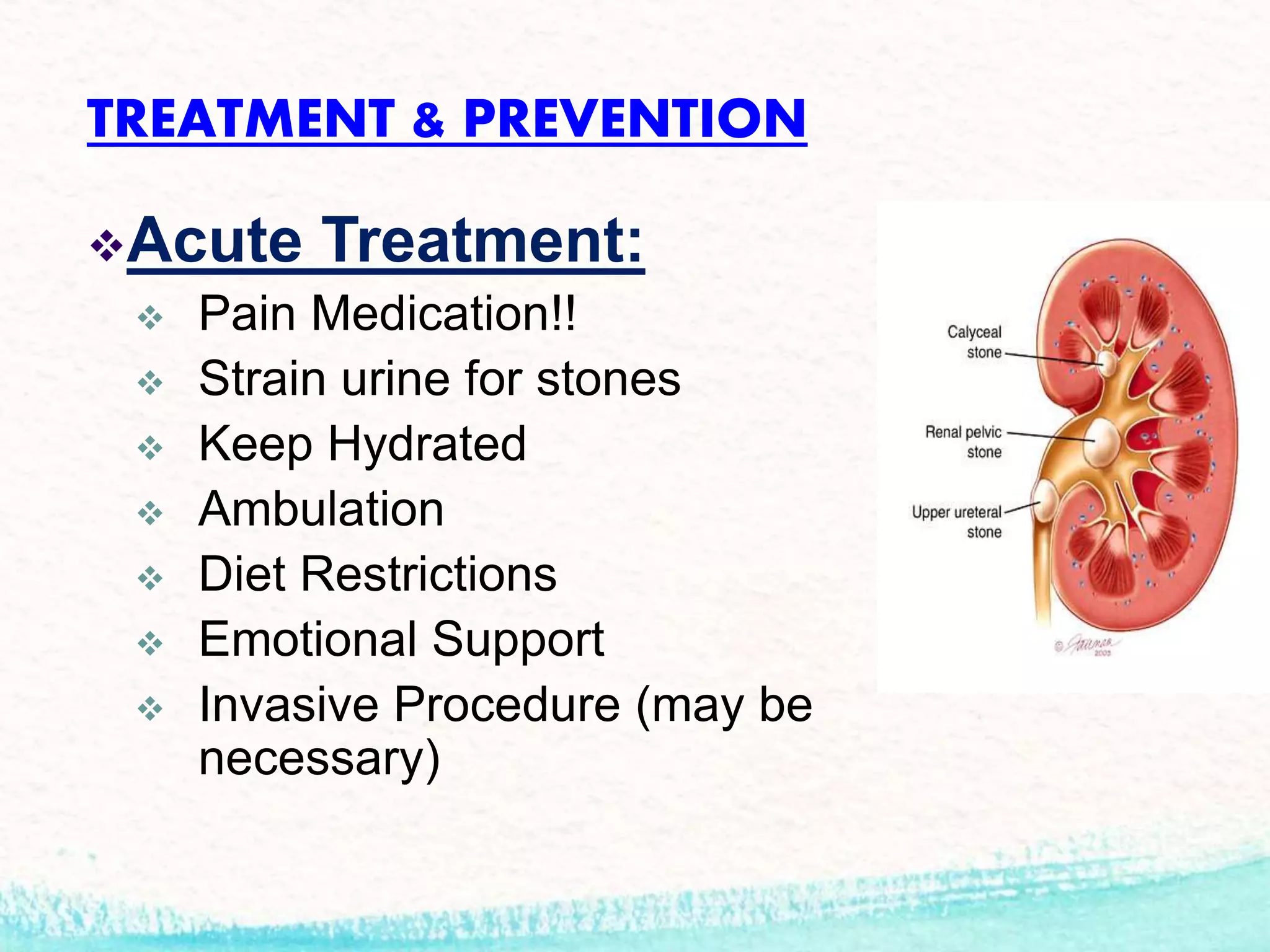 Presentation kidney-stone final | PPTX