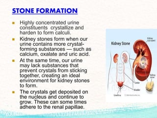 Presentation kidney-stone final | PPTX