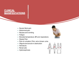 presentation-kidney-stonefinal.pptx