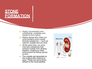 presentation-kidney-stonefinal.pptx