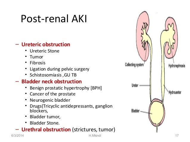 kidney injury-Hamisi Mkindi,Presentation
