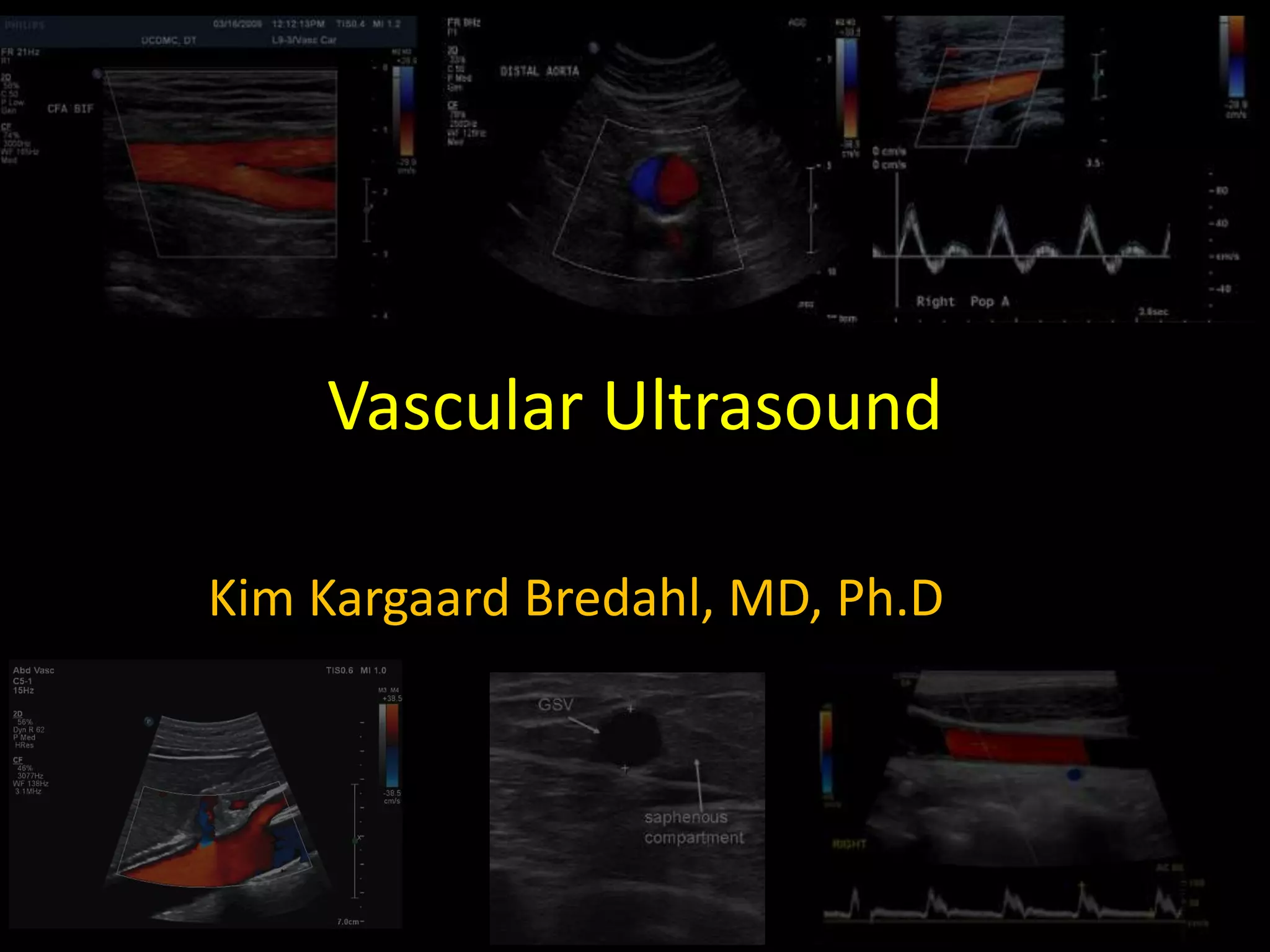 presentation-kim-bredahl-doppler-ultrasound.pdf