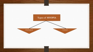 myopia | PPTX