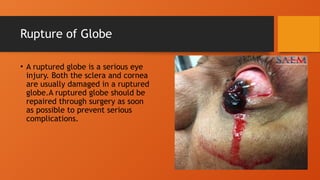 Presentation - Ocular Trauma.- injury to eye | PPTX