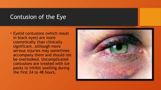 Presentation - Ocular Trauma.- injury to eye | PPTX