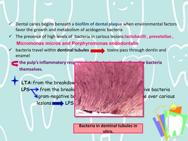 presention - pulpal pathosis | PPTX | Dental Health | Diseases and ...