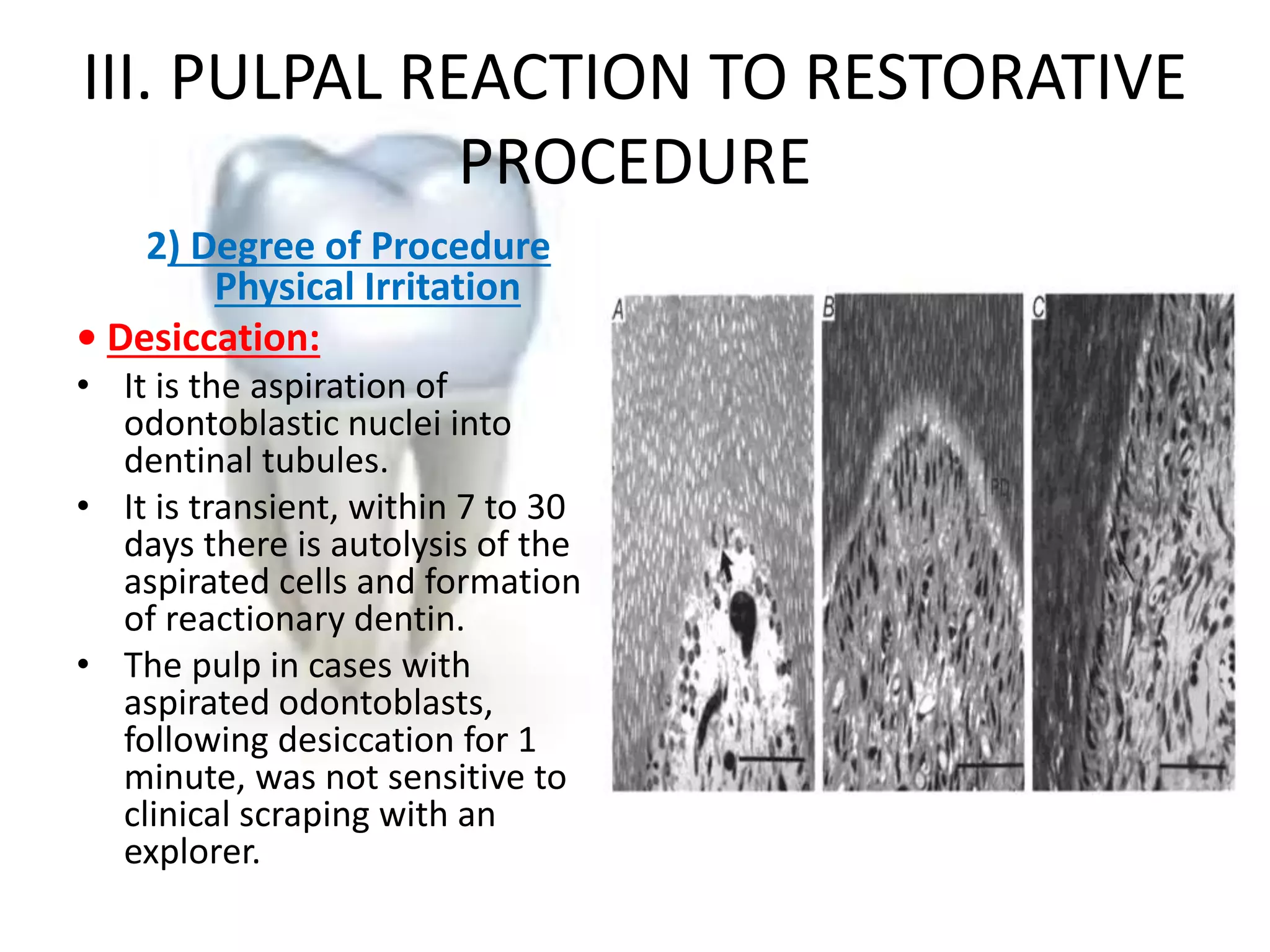 Pulpal Reactions to Dental Caries and Dental Proceudres | PPTX