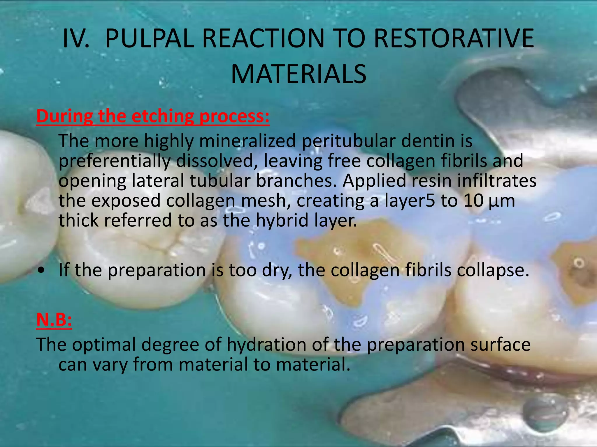 Pulpal Reactions to Dental Caries and Dental Proceudres | PPTX