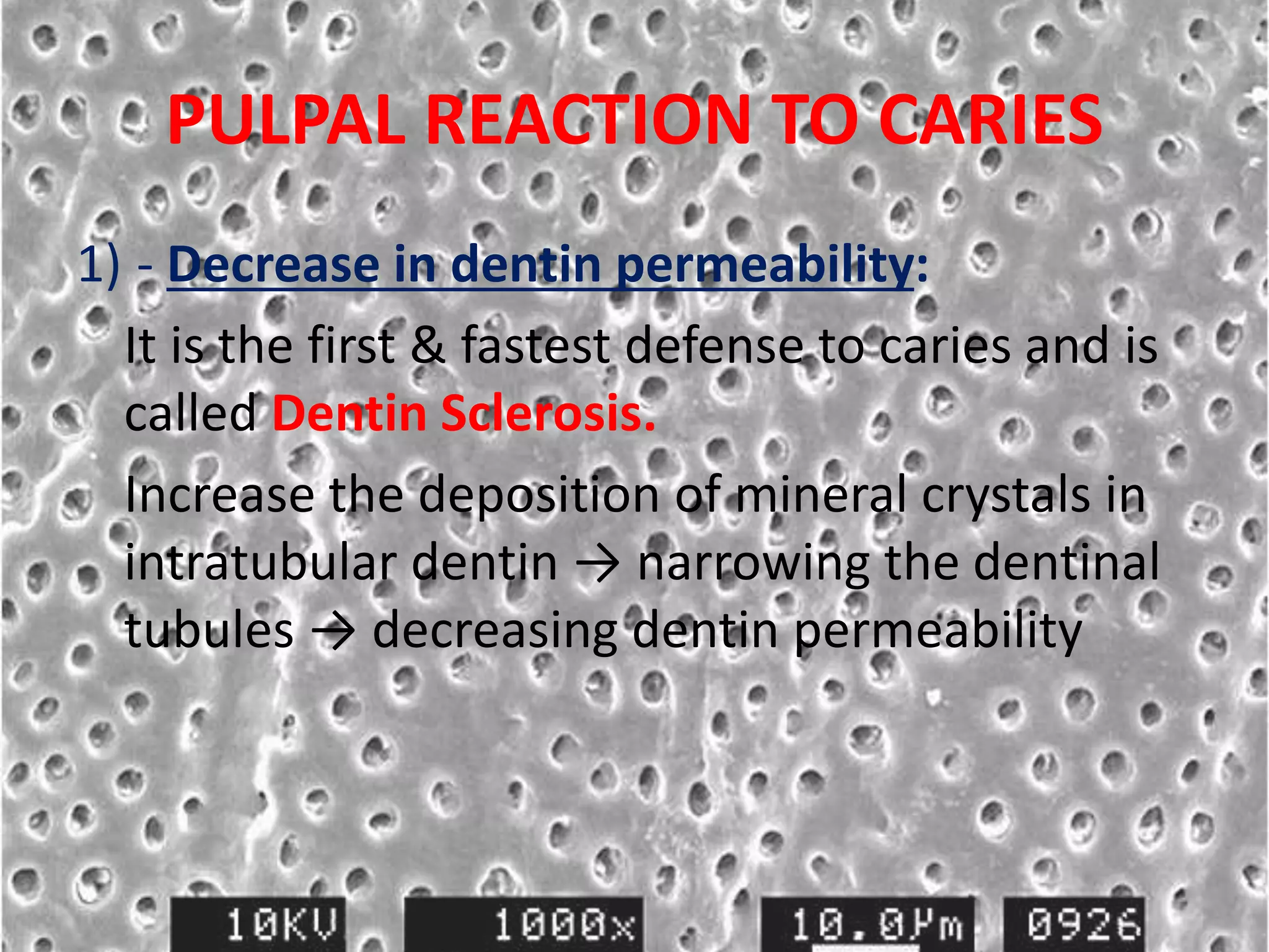 Pulpal Reactions to Dental Caries and Dental Proceudres | PPTX