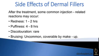 Dermal Fillers Treatment | PPT