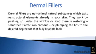 Dermal Fillers Treatment | PPT
