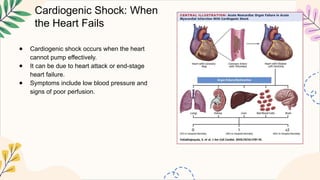The Mechanism and Pathophysiology of Shock | PPTX