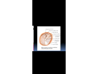 Ear perforation Presentation-WPS Office.pptx