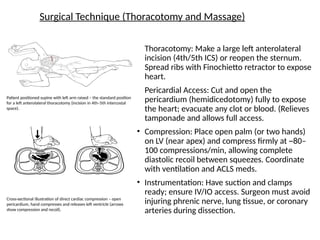 Internal cardiac massage Presentation ppt | PPTX