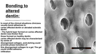Presentation- yahia (1) adhesion in dentistry.pptx