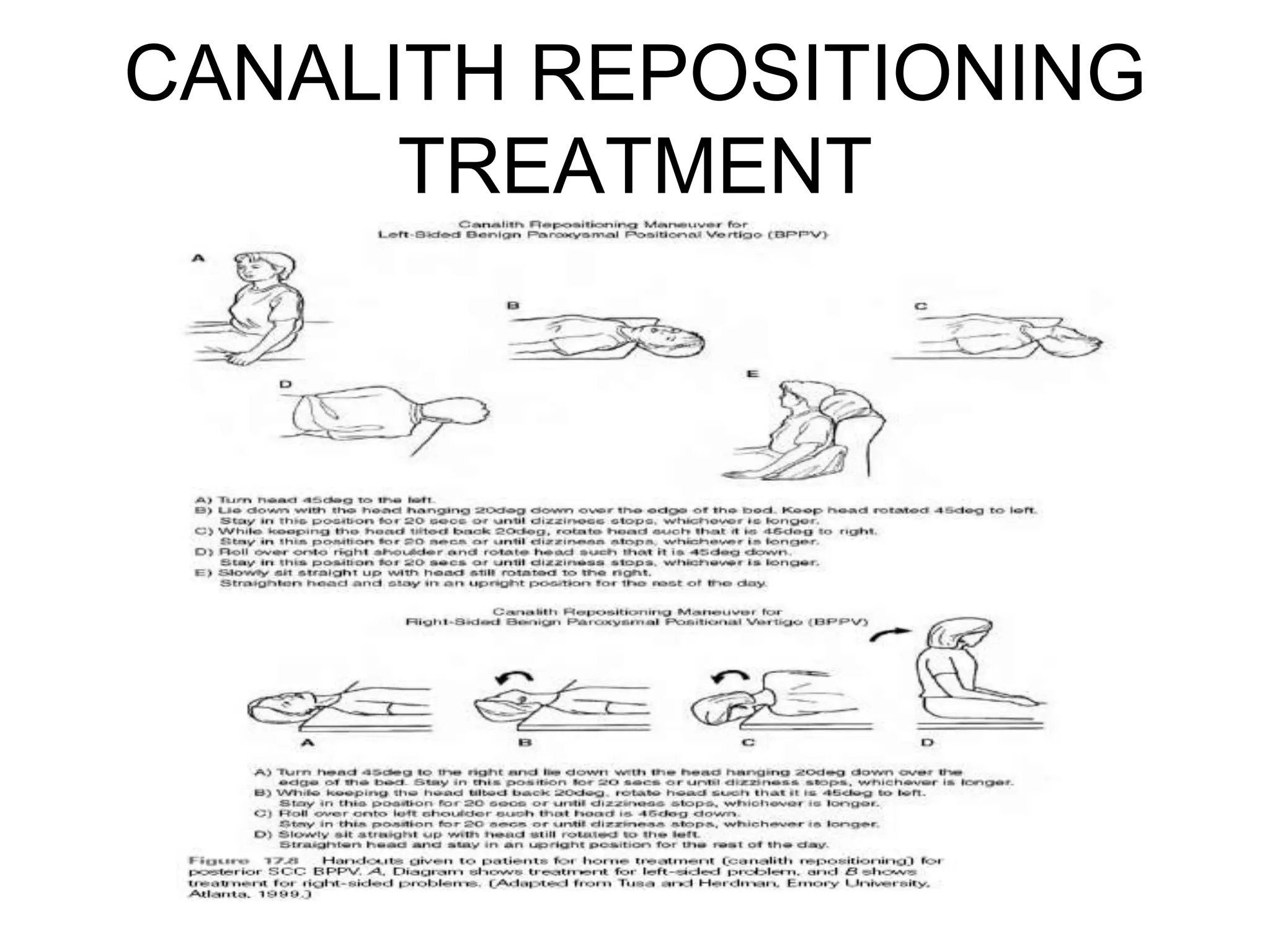Presentation01mhb vestibular rehab | PPT