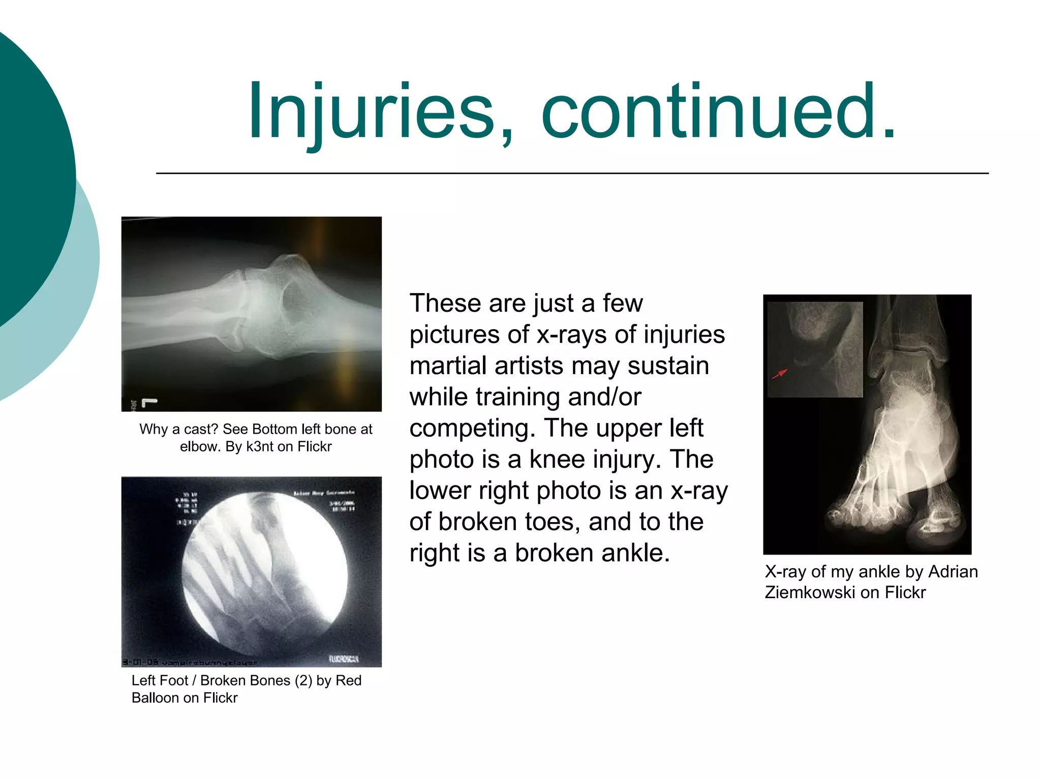 Rasmussen: Common Martial Arts Injuries | PPT