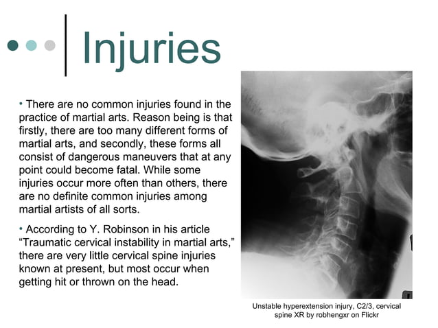 Rasmussen: Common Martial Arts Injuries | PPT | Death, Injury, or ...
