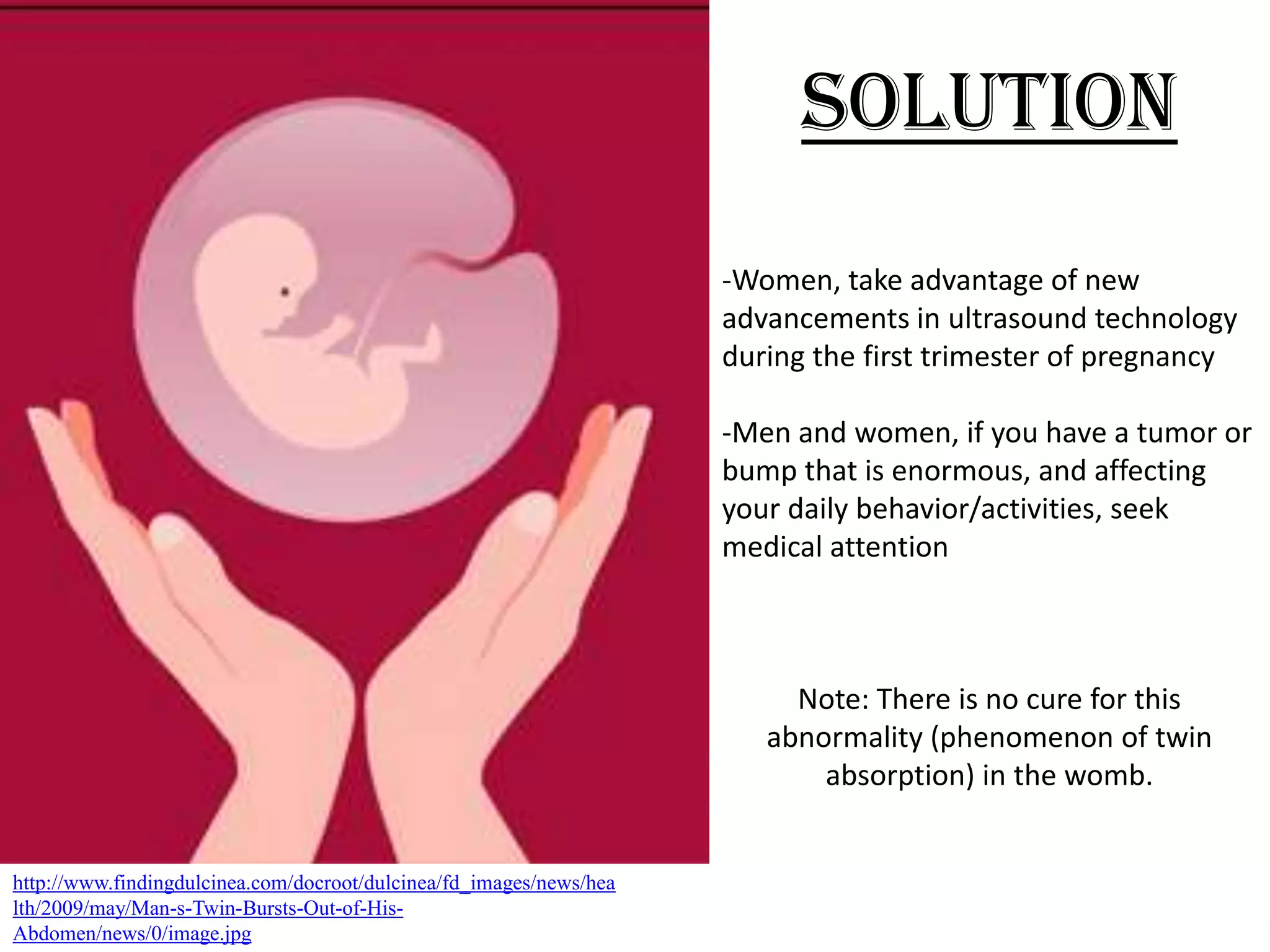 bio wiki: Twin Absorption | PPTX