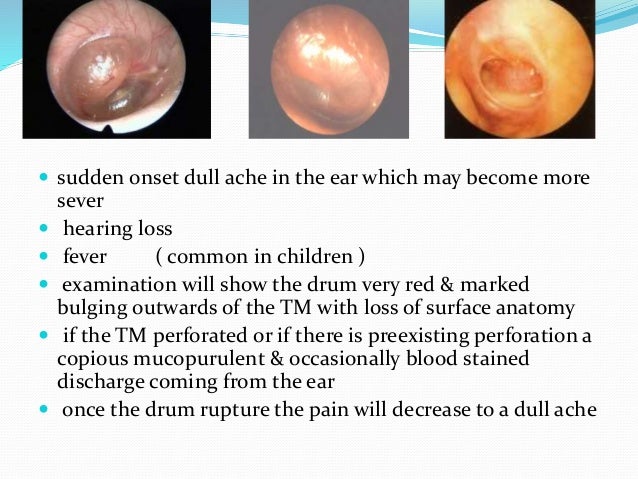E.N.T 5th year, 4th & 5th lectures (Dr. Muaid)