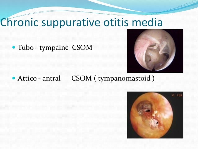 E.N.T 5th year, 4th & 5th lectures (Dr. Muaid)