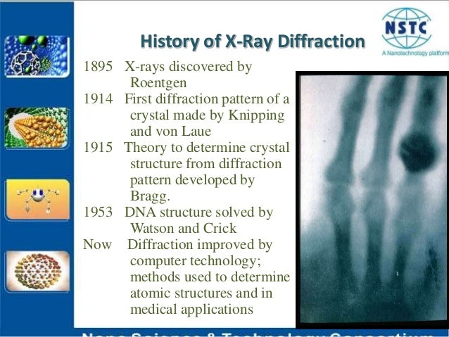 X-Ray Diffraction Technique