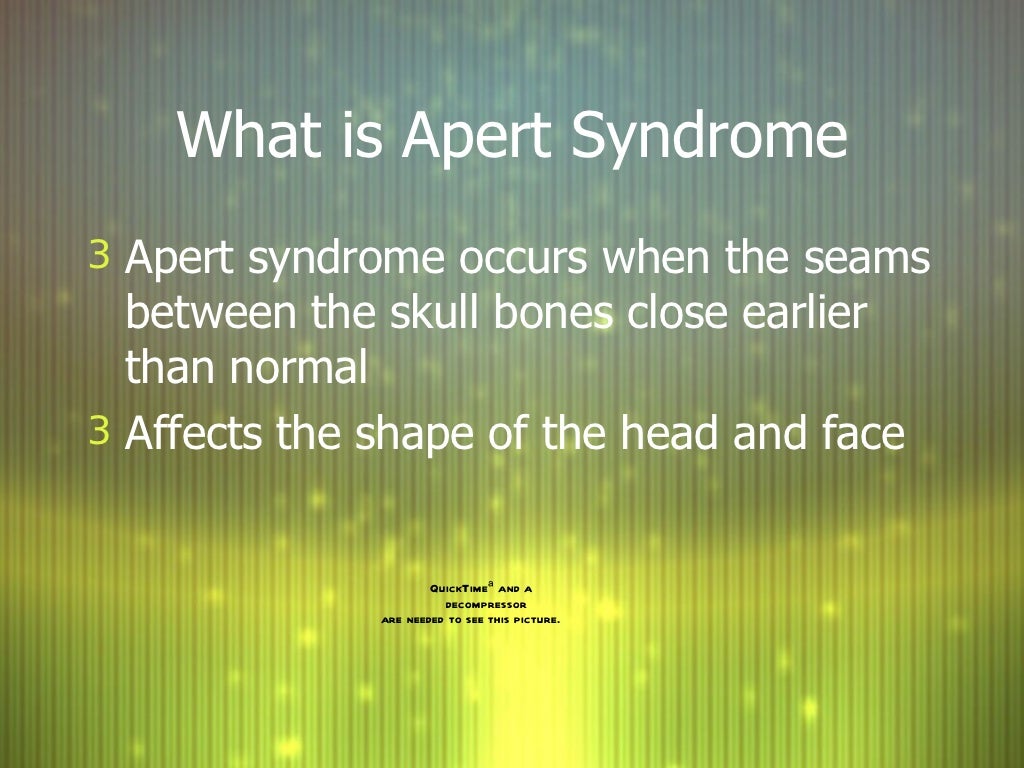 Apert Syndrome