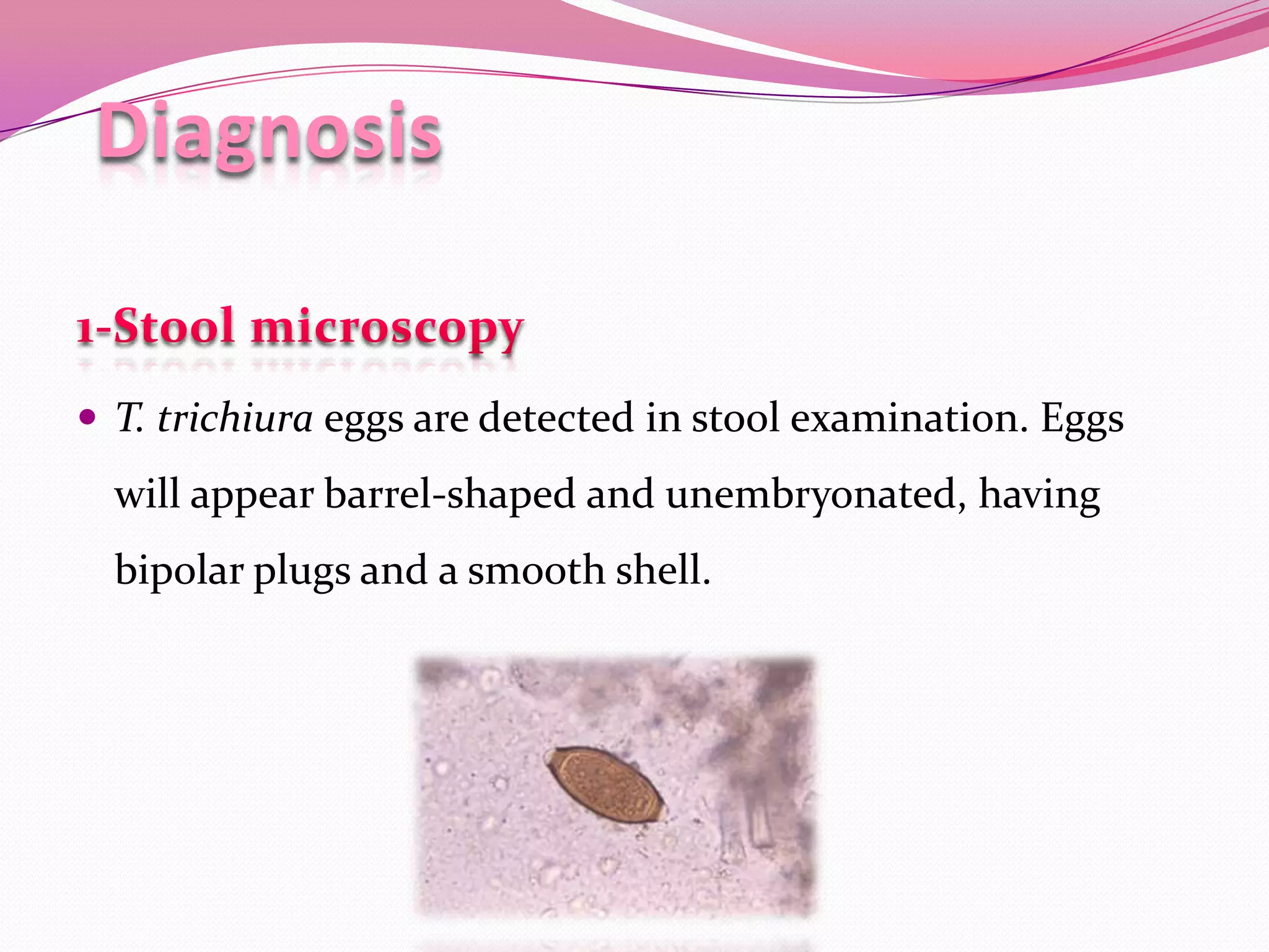 TRICHURIS TRICHURIA | PPTX