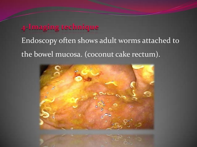 TRICHURIS TRICHURIA | PPTX | Digestive Disorders | Diseases and Conditions