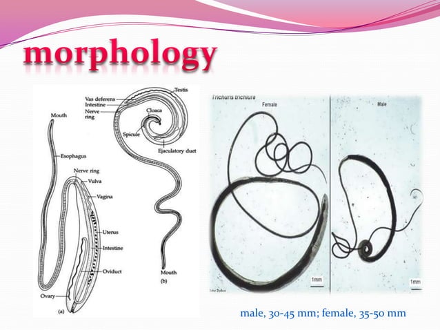 TRICHURIS TRICHURIA | PPTX | Digestive Disorders | Diseases and Conditions