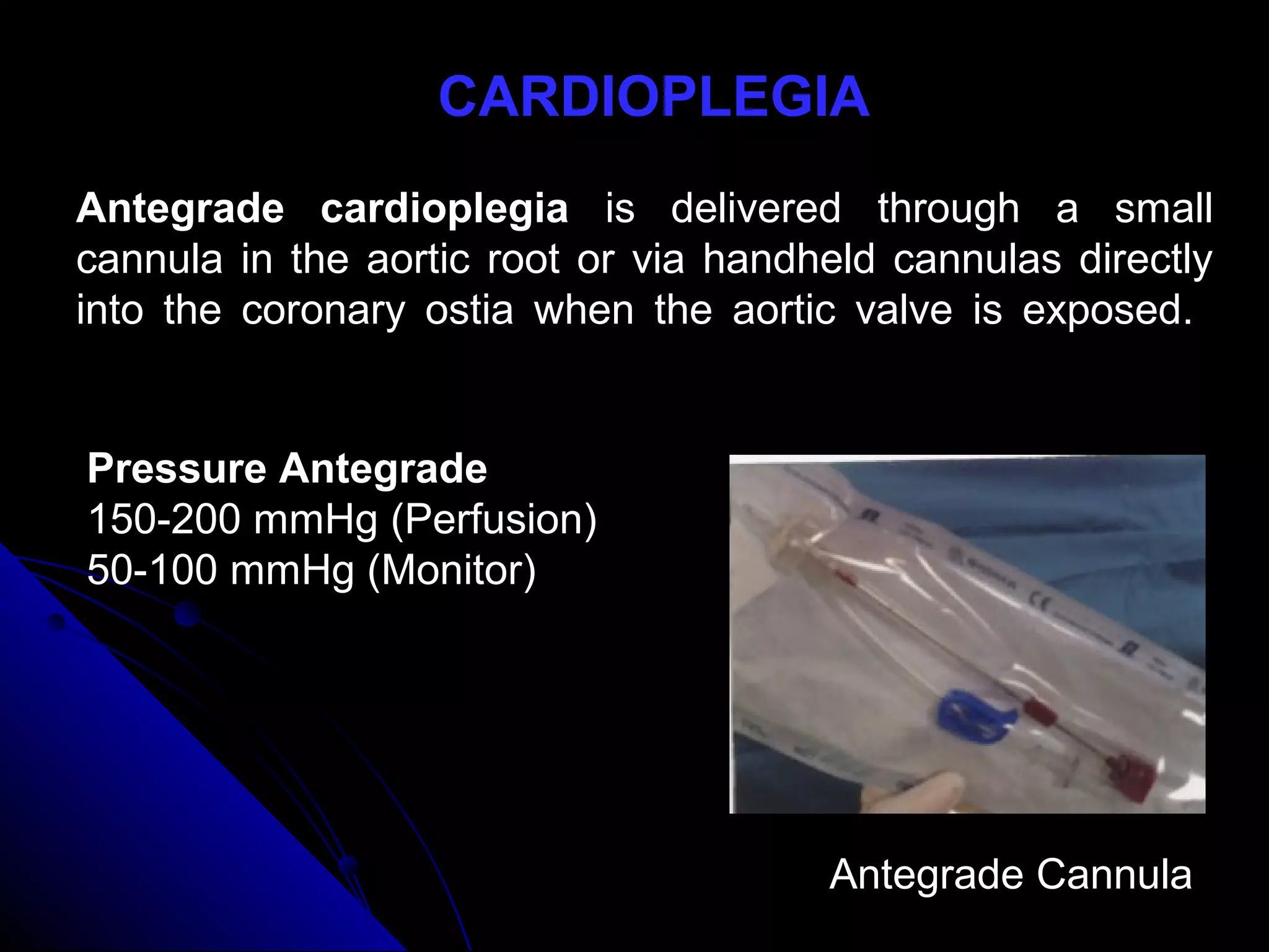 principles of cardiopulmonary bypass | PPT