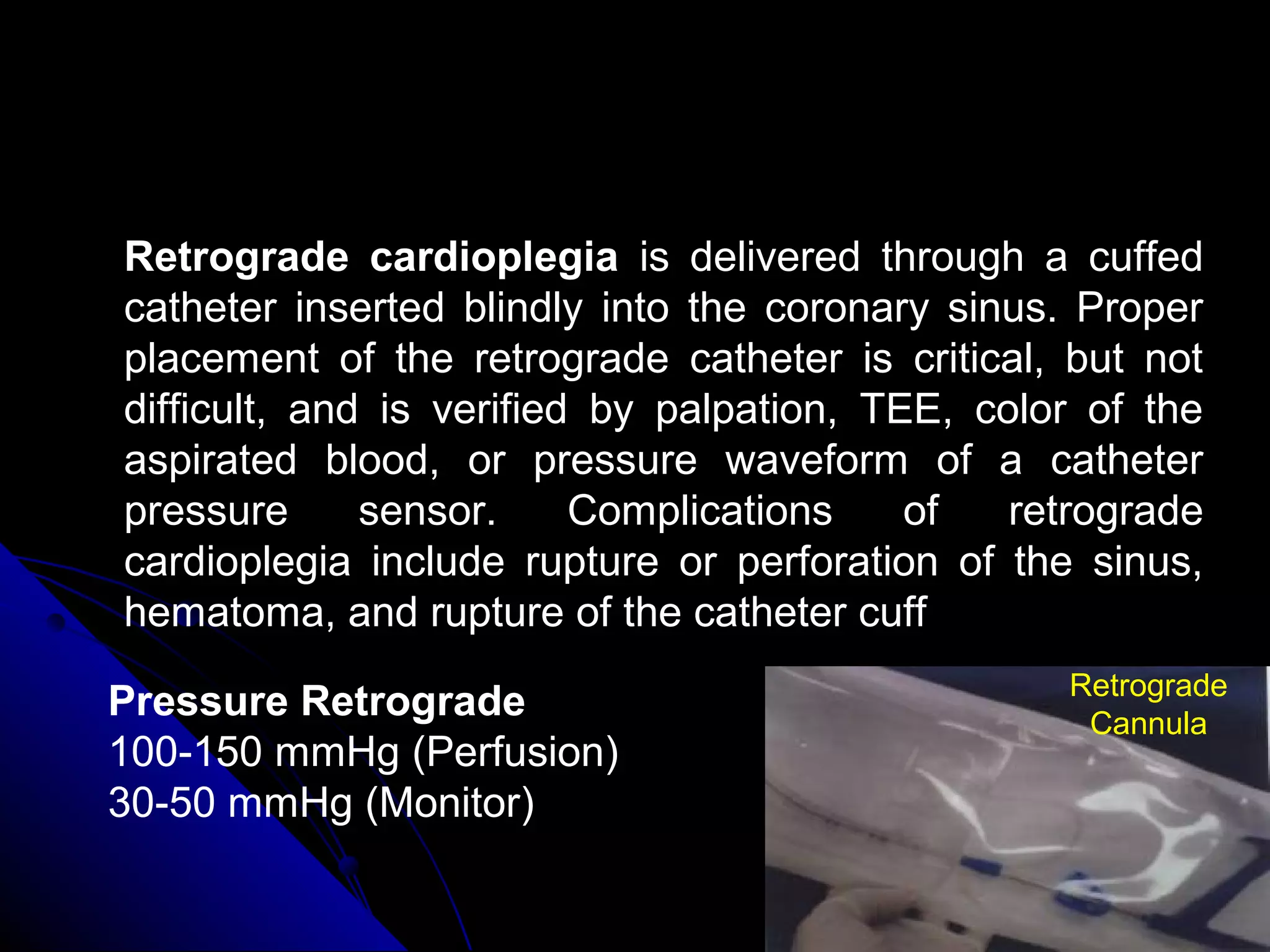 principles of cardiopulmonary bypass | PPT