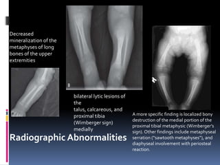 Congenital Syphilis Xray