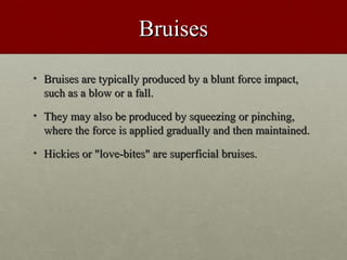 Wounds in forensic medicine | PPT
