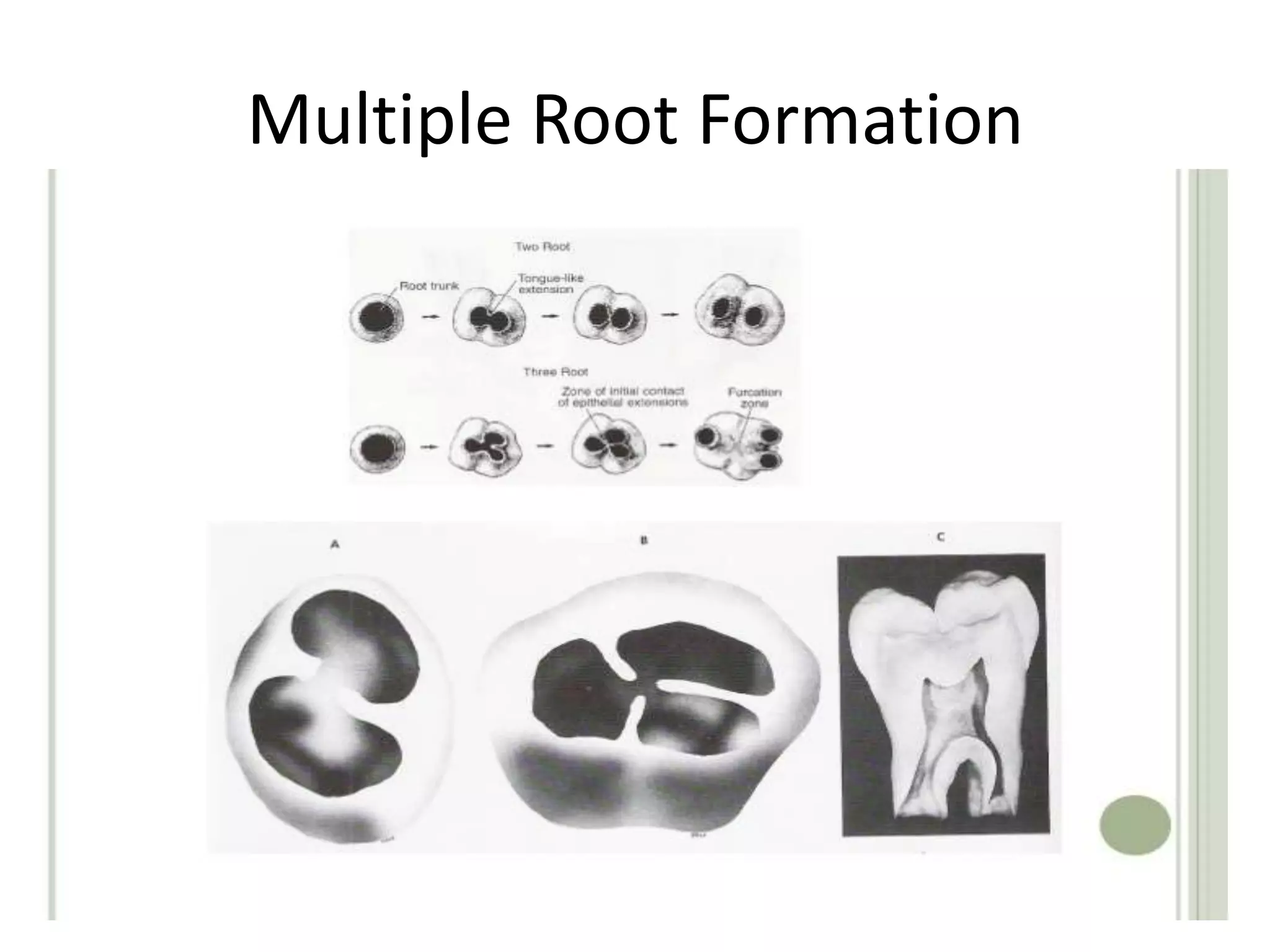 Formation of Permenant tooth, root and supporting tissues | PPTX