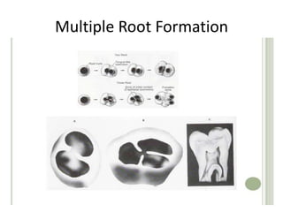 Formation of Permenant tooth, root and supporting tissues | PPTX