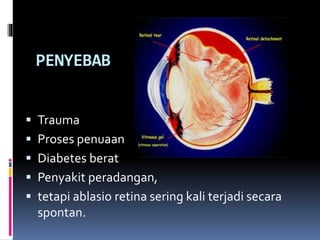 Presentation1 | PPTX