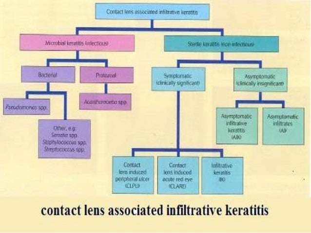 Contact Lens-Induced Acute Red Eye(CLARE)