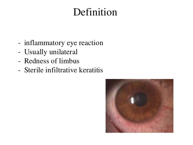 Clare Contact Lens Acute Red Eye Contact Lens Induced Acute Red