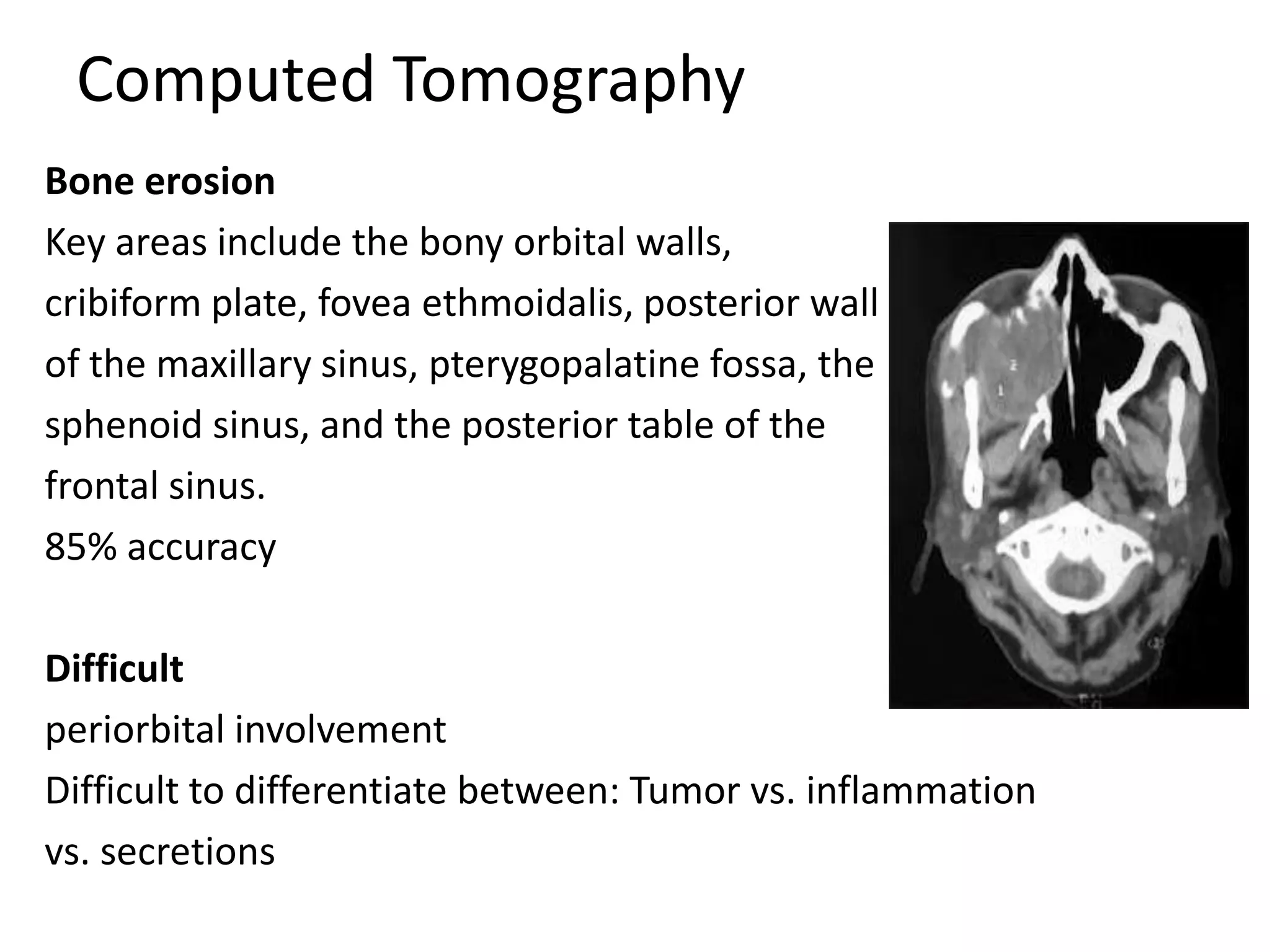 CARCINOMA MAXILLARY SINUS MANAGEMENT RADIATION ONCOLOGY | PPTX