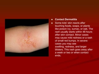 evaluating a child with febrile rash | PPTX
