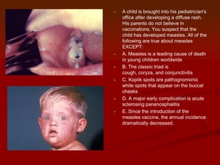 evaluating a child with febrile rash | PPTX