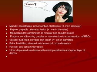 rashes when to worry | PPTX