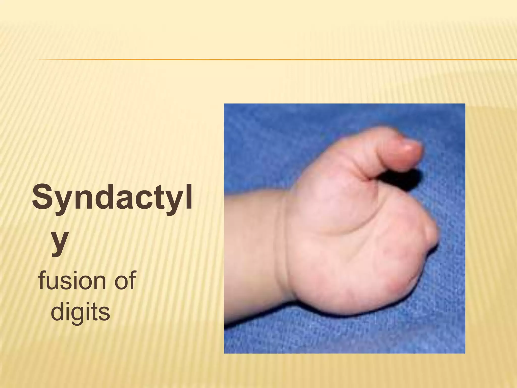 Presentation1.pptx limbs | PPTX